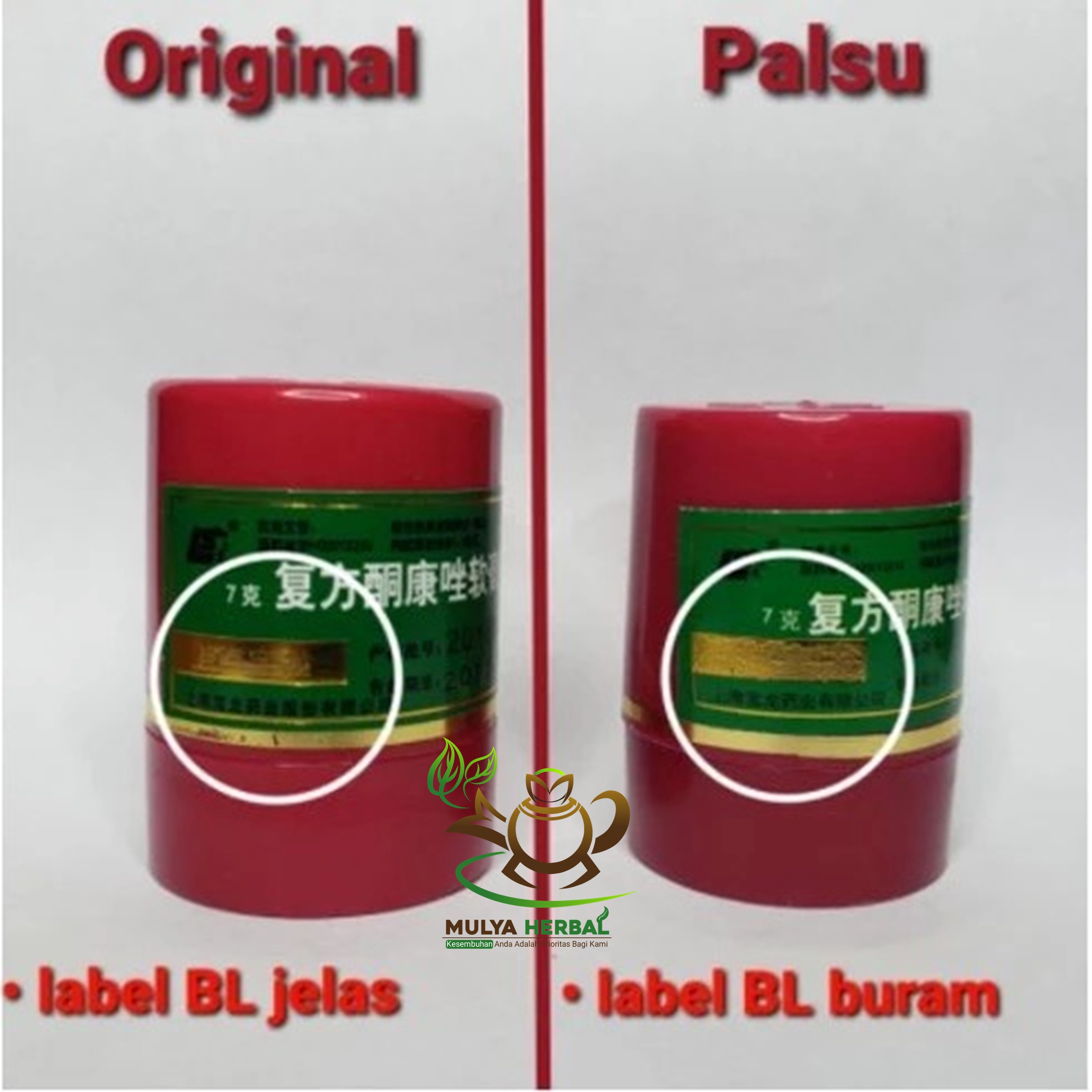 Jual Salep BL – Obat Gatal Kulit, Kadas, Kurap, Eksim, Jamur